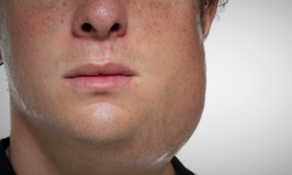 Highly contagious mumps outbreak hitting Auckland gyms | The Spinoff